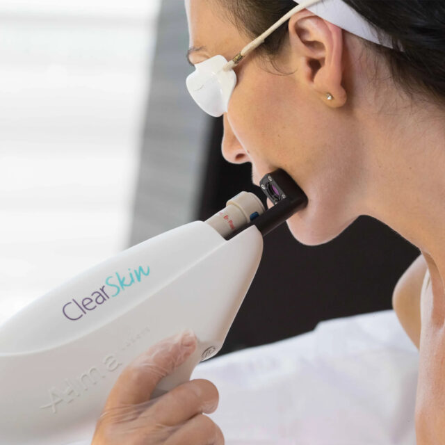 Treatments - Derma Revive Skin Clinic