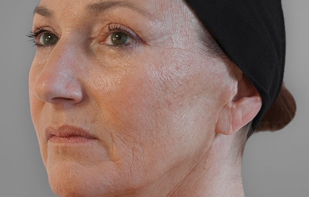 ELLANSÉ - Derma Revive Skin Clinic