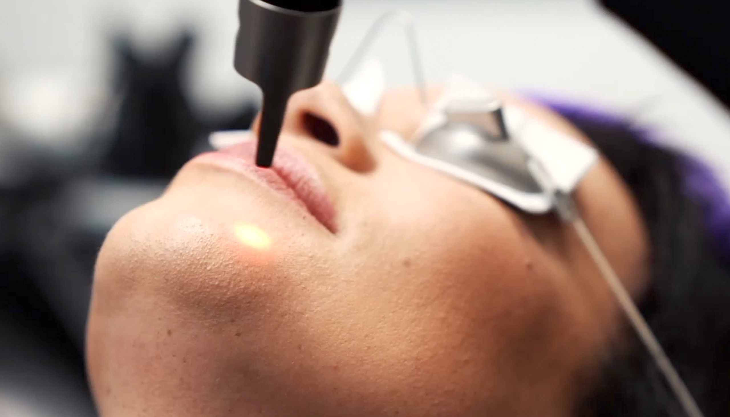 How Many Sessions Does PicoSure Really Take for Skin Rejuvenation ...