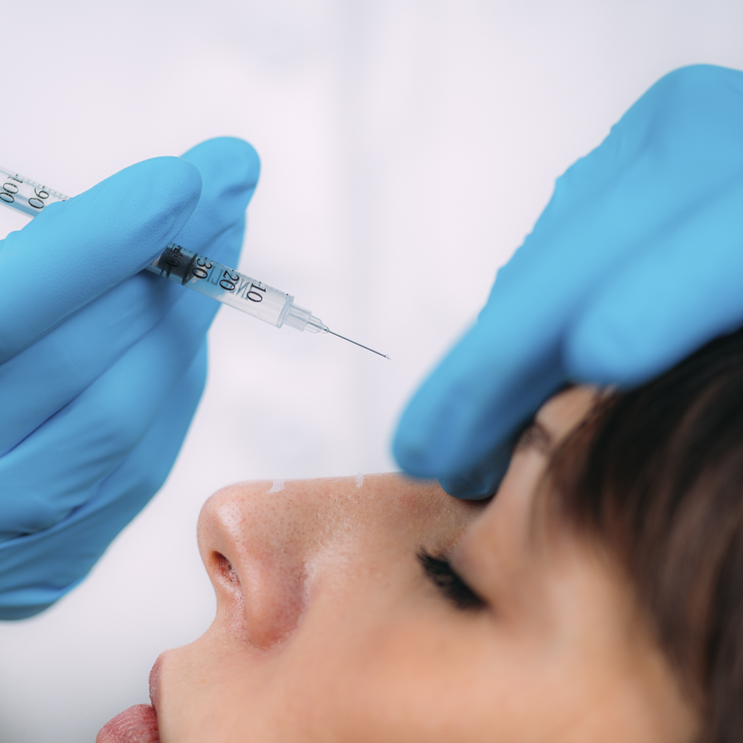 Bunny Lines - Derma Revive Skin Clinic