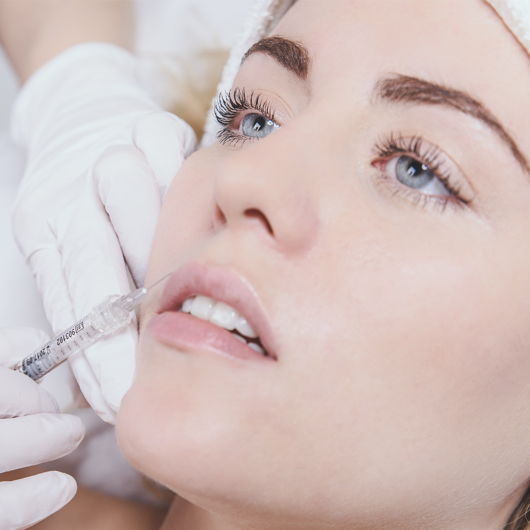 Lip Flip - Derma Revive Skin Clinic